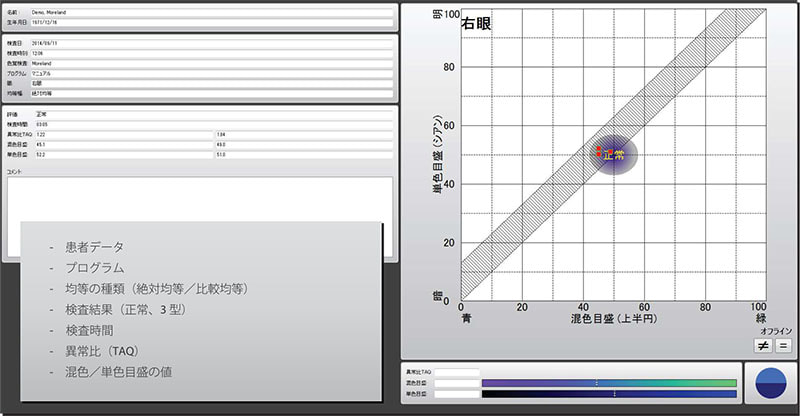 検査項目 | HMC Anomaloskop | 製品情報 | ニコンソリューションズ